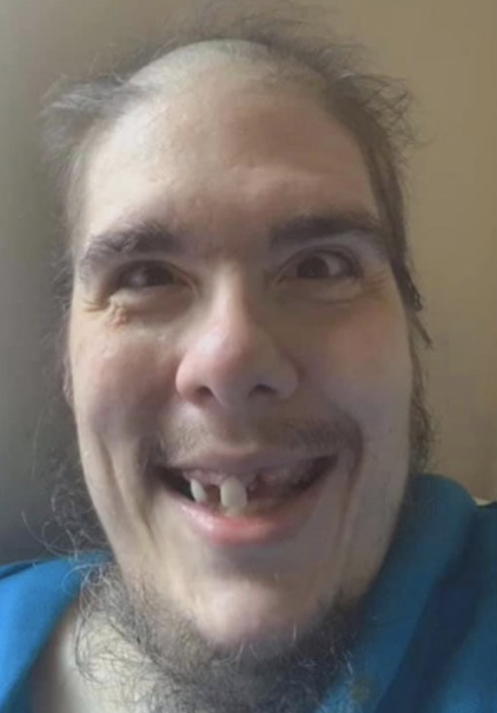 ‘My 600-Lb. Life’ Star Steven Assanti Found Dead – All About The Tea ...