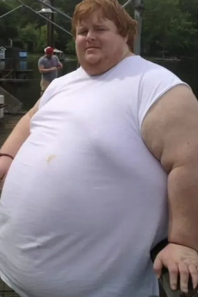 'Family by the Ton' Star Casey King Loses 600 Pounds But His Sagging ...