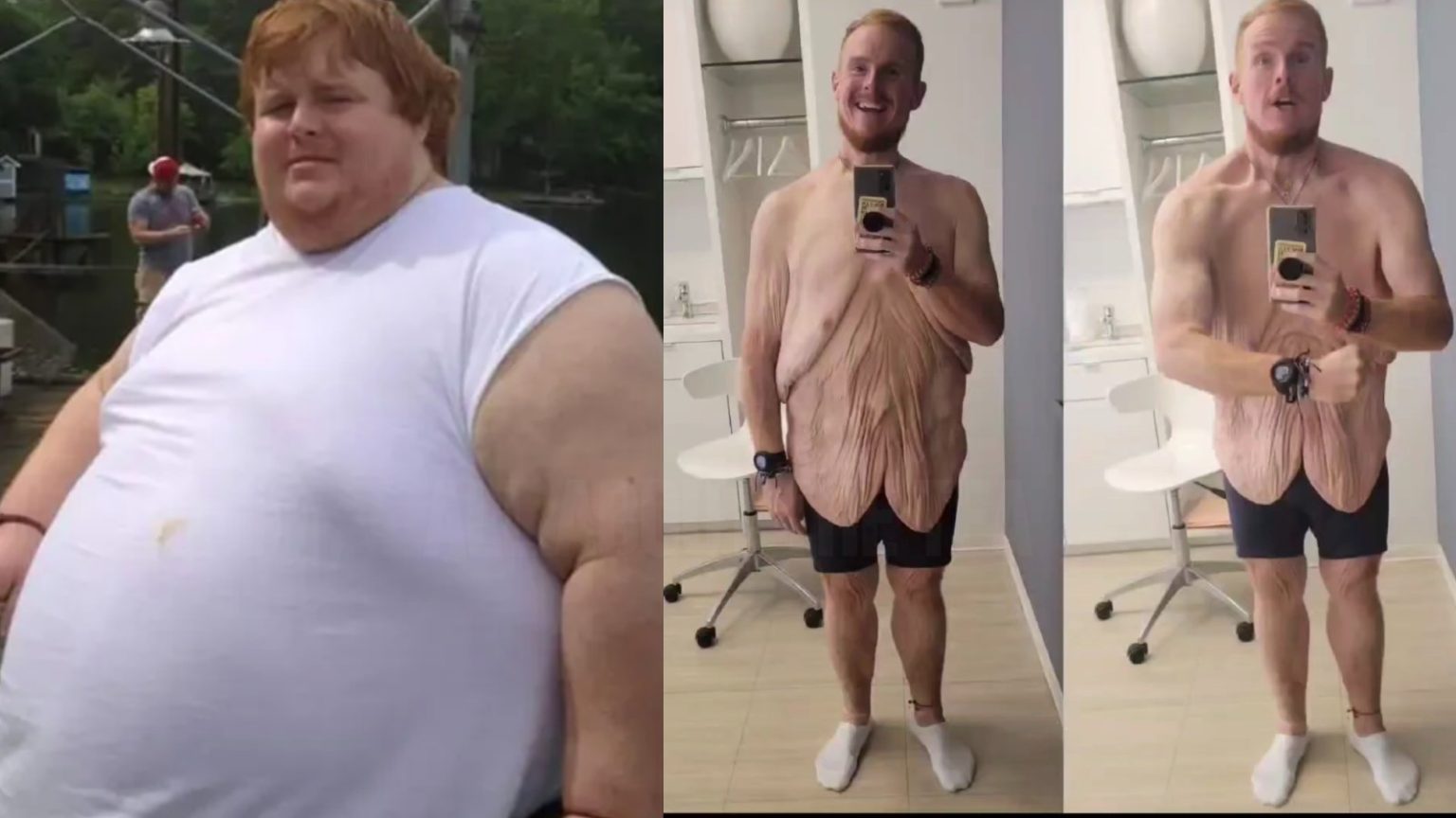 'Family by the Ton' Star Casey King Loses 600 Pounds But His Sagging Skin Shocks Fans