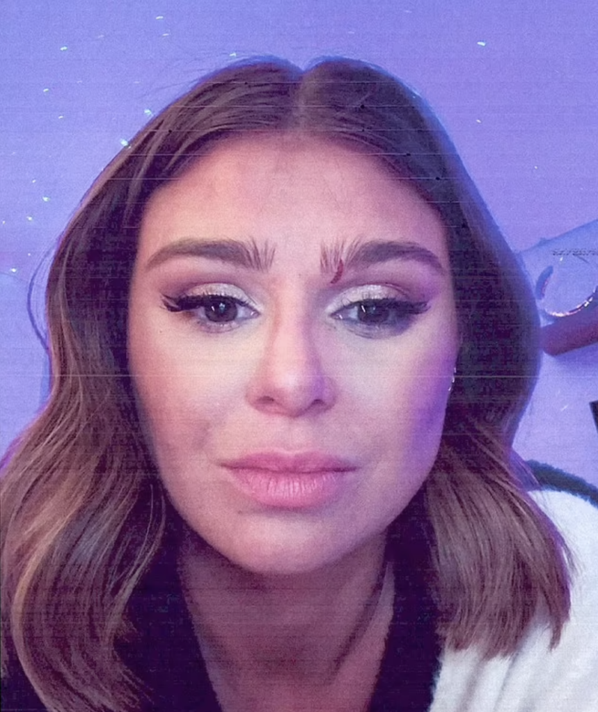 Scheana Shay Calls Raquel Leviss A 'Liar' Over Black Eye Claims and Fans Provide Receipts