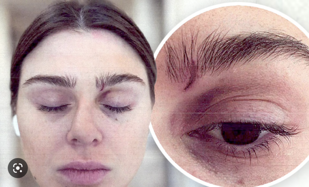 Raquel Leviss Debuts Black Eye After Being Punched By Scheana Shay