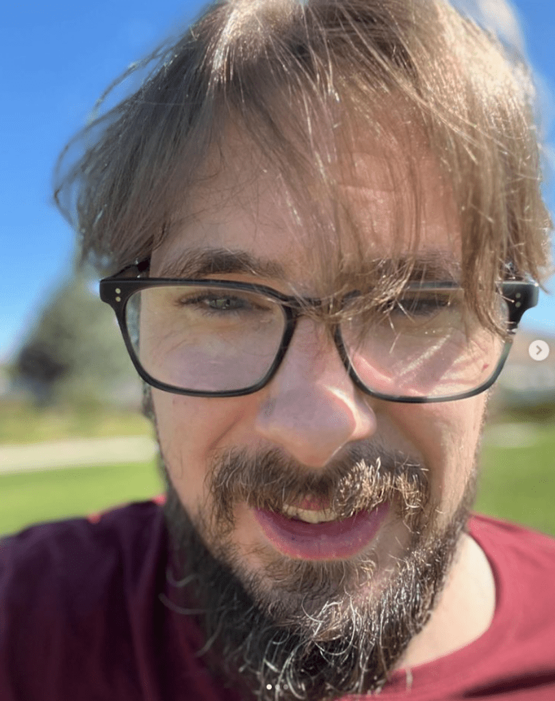 Colt Johnson Suffers Another Gruesome Injury While Filming 90 Day ...