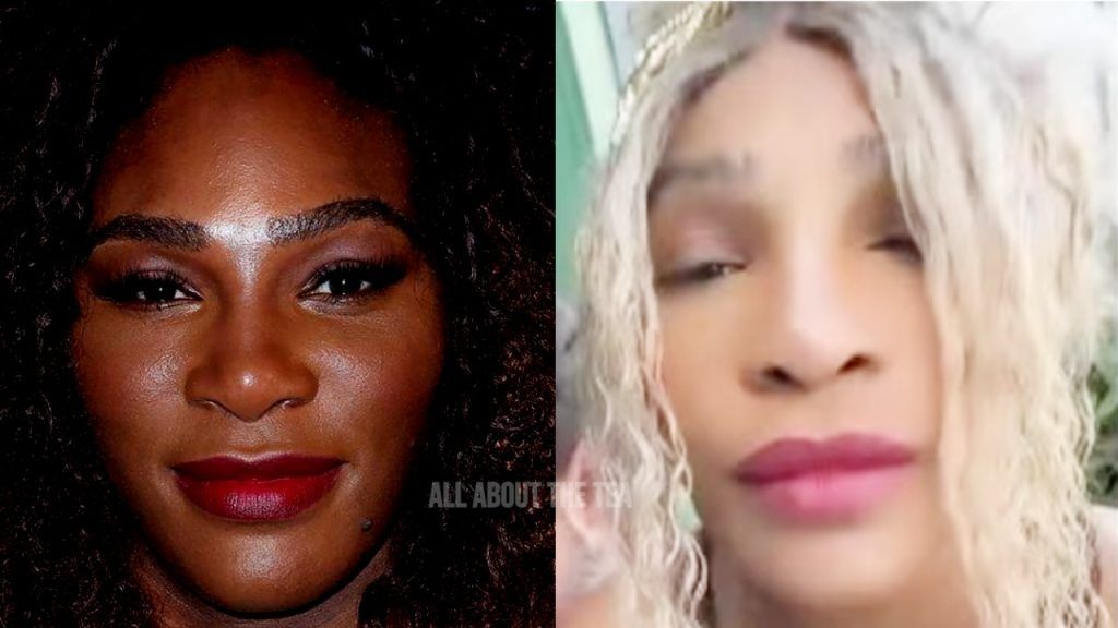 Serena Williams Denies Following In Michael Jackson's Footsteps By Bleaching Her Skin!