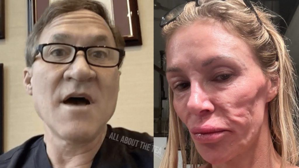 Dr. Terry Dubrow Says Brandi Glanville’s Disfigured Face is a 'Ticking ...