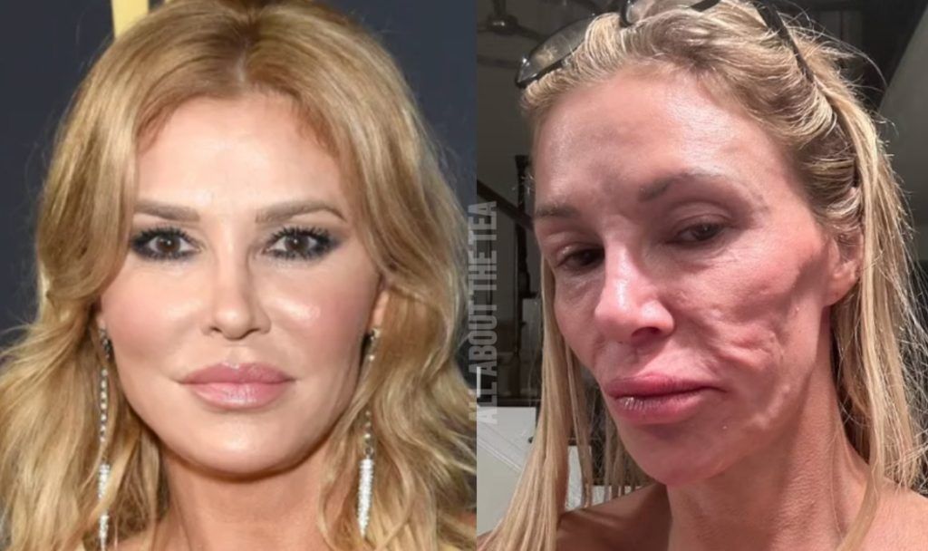 Brandi Glanville Plunges Into 'Deep Depression' Due To Horrifying ...